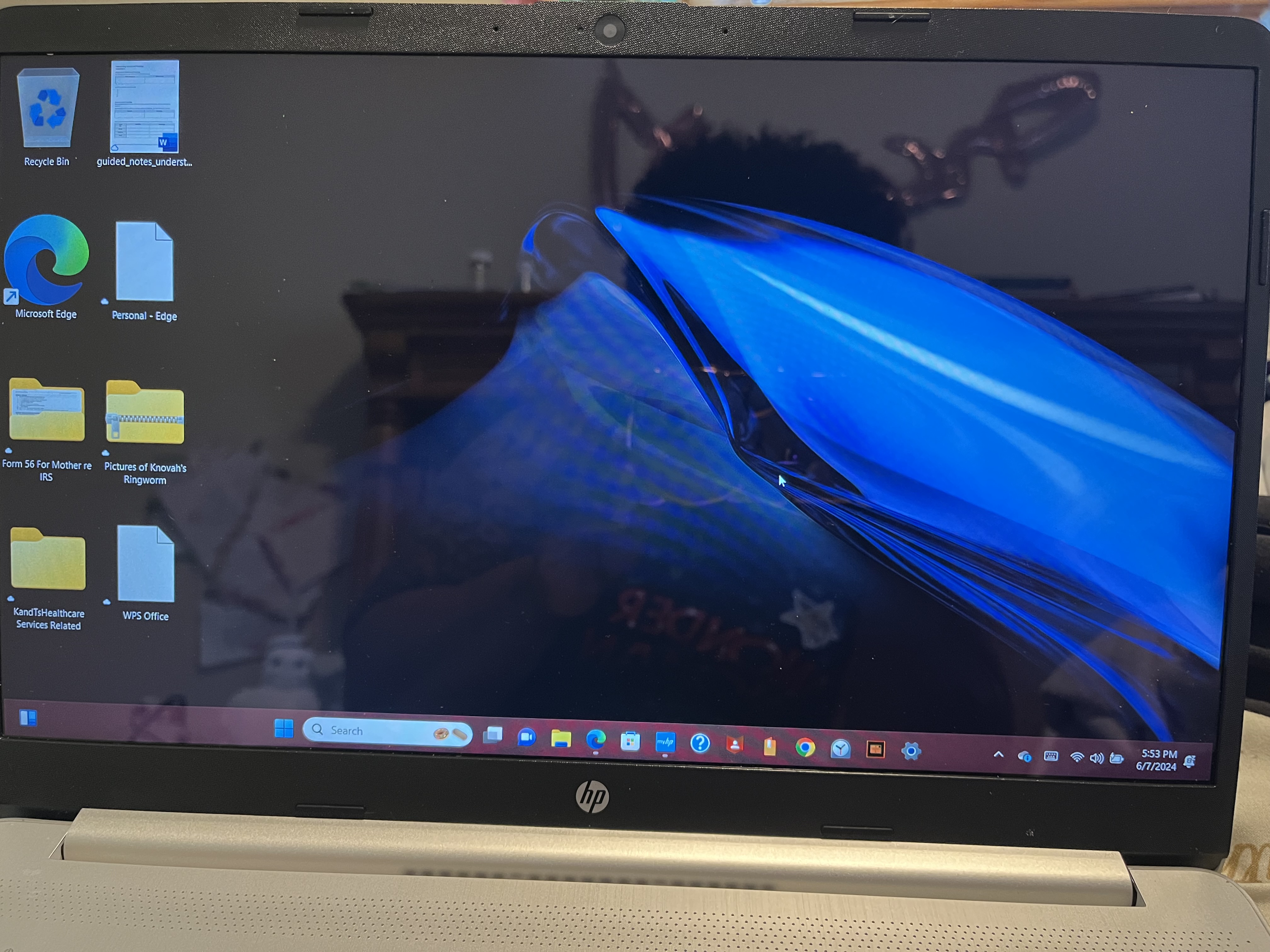 Blue Dot Above Short Horizontal Line In Screen (Sent Off For... - HP ...